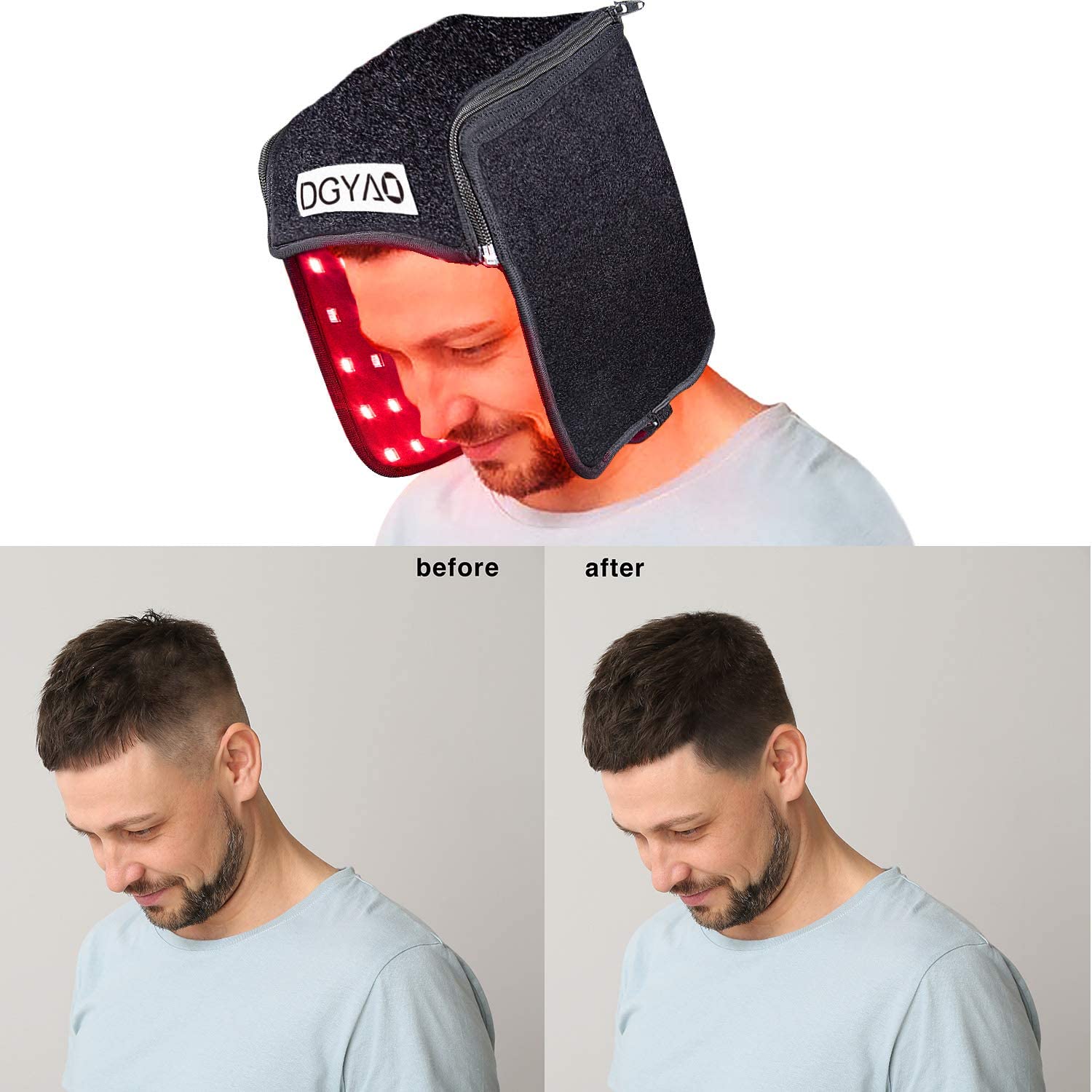 dgyao® Red Light & Infrared Light Therapy for Hair Loss Hair Growth Cap ...